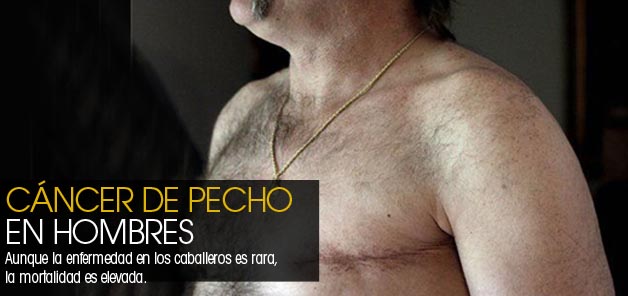 Cáncer de pecho en hombres | La Raza del Noroeste