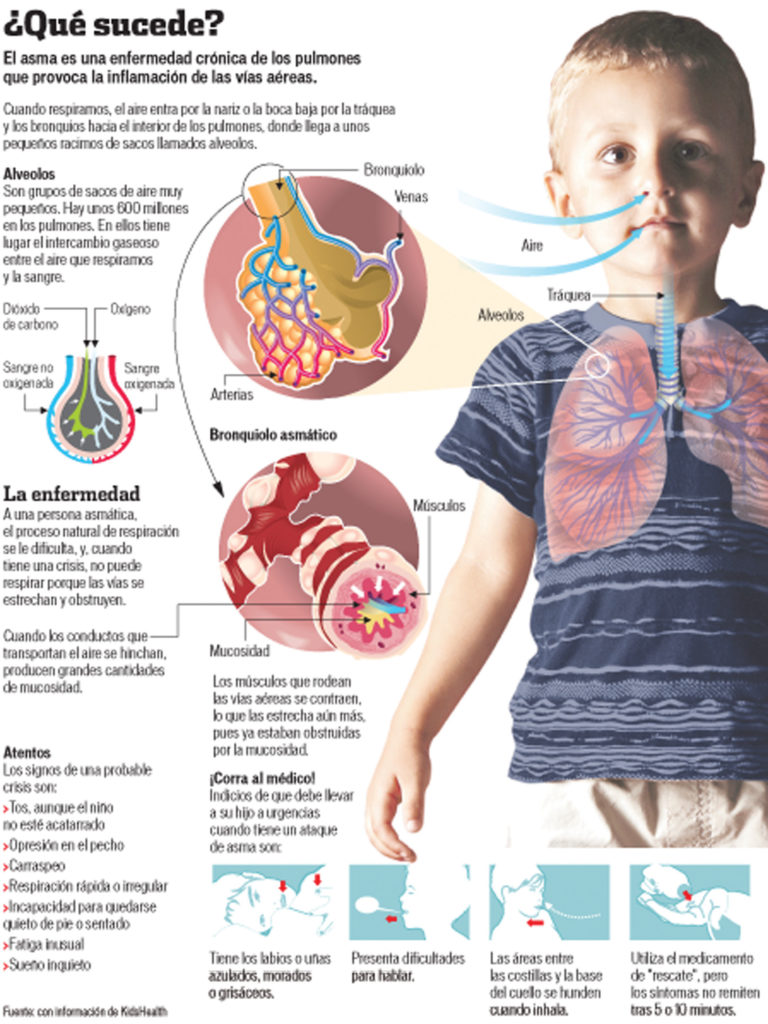 Asma infantil: un foco rojo | La Raza del Noroeste